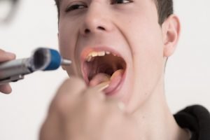 Mandelentzündung - diese 10 Hausmittel verschaffen Linderung!